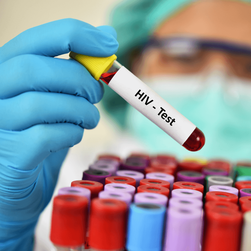 HIV und STDs - Johann Strauss Apotheke 1040 Wien